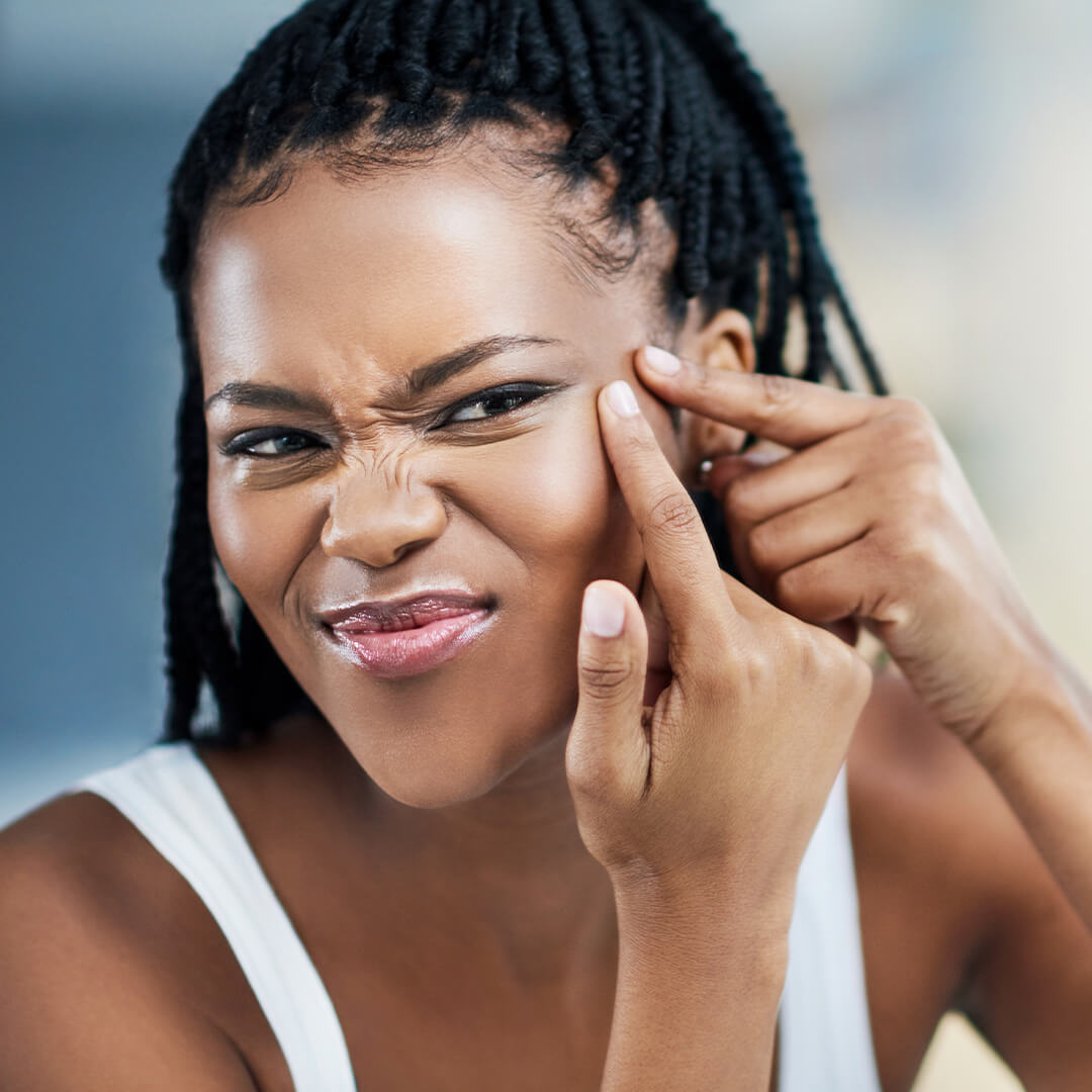What Is Stress Acne? Causes and Treatments From Expert | IPSY