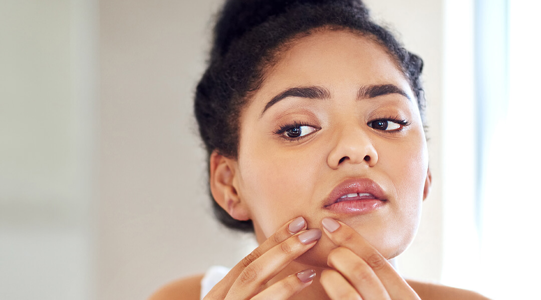 How to Get Rid of Pimples Fast - 13 Derm-Approved Acne Tips