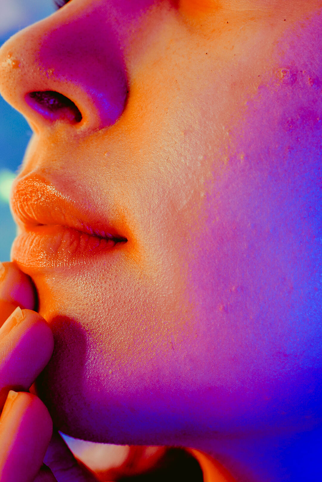 How to Get Rid of Sebaceous Filaments From a Derm